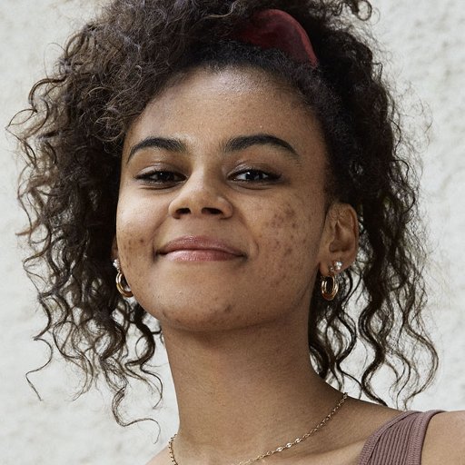 10 Cara Mengatasi Jerawat Meradang, Kenali Dulu Seperti Apa