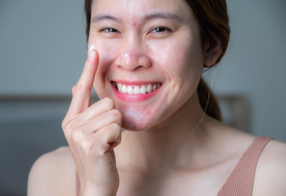 Begini 7 Cara Mengatasi Jerawat secara Efektif - La Roche Posay